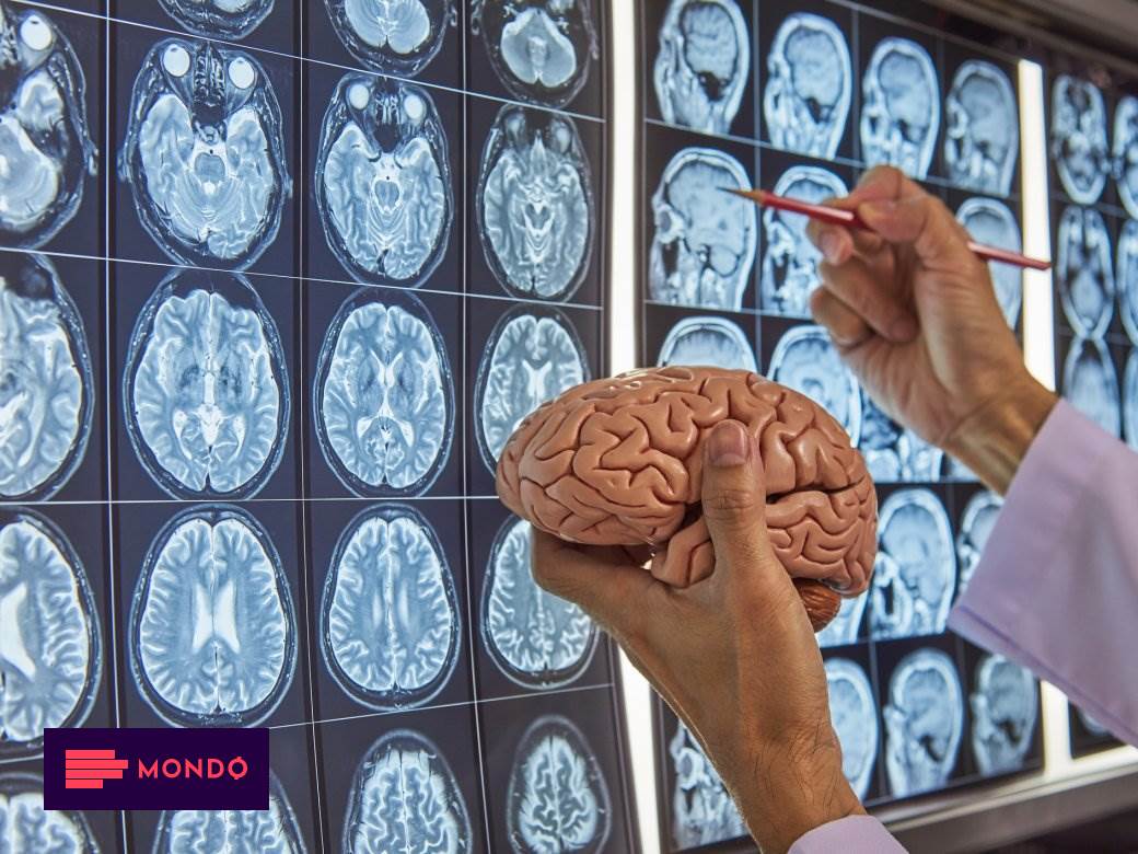 Transplantacija glave | Magazin | Stil