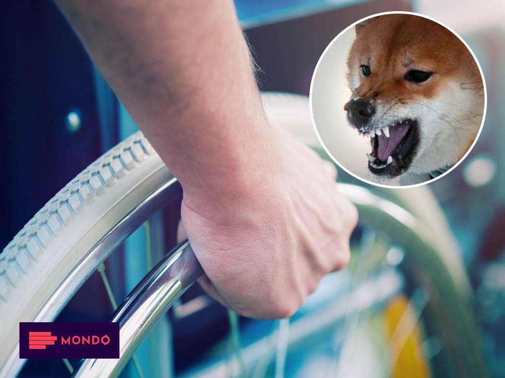 Čovjeku odsjekli obje noge zbog ujeda psa: Ista zvijer je mjesec dana ...