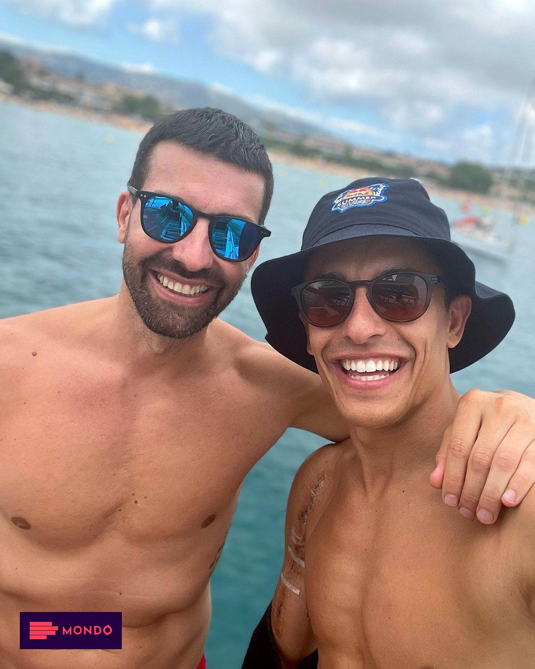 Mark Markez pokazao ožiljak nakon operacije | Sport | Ostali sportovi