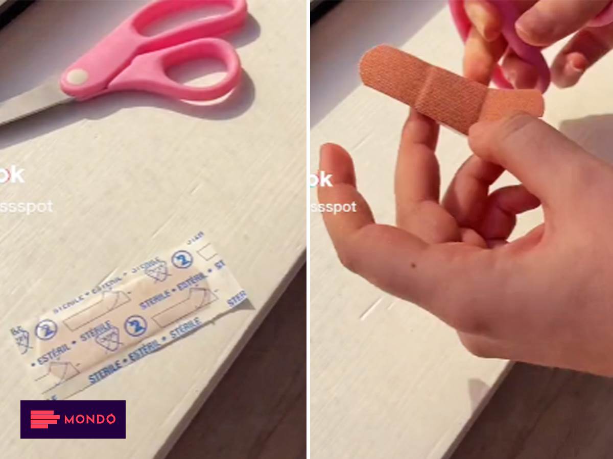 Kako se pravilno stavlja flaster | Magazin | Stil